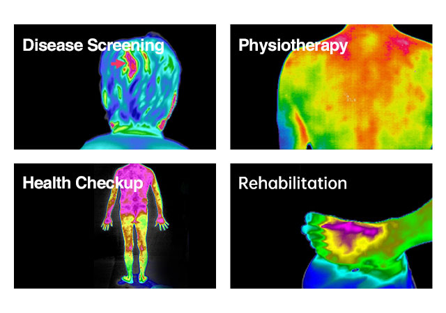 Non Invasive Infrared Camera Core for Thermal Imaging System Medical ...